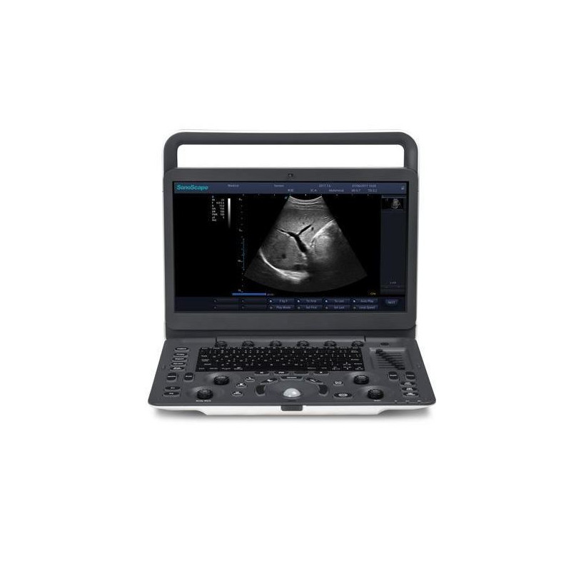 Ecografo E1 Sonoscape Company LTD