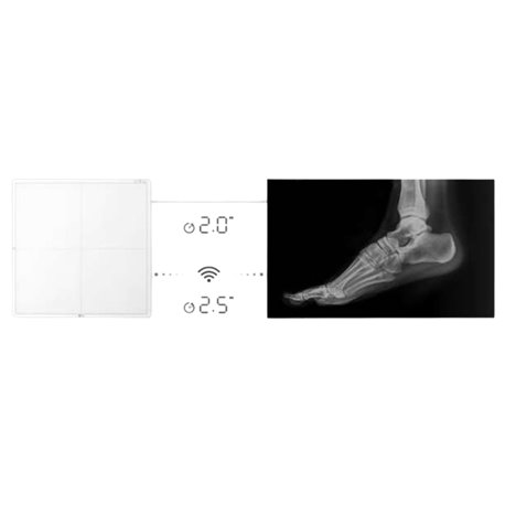 Detector Digital de Rayos X 17HK701G-W